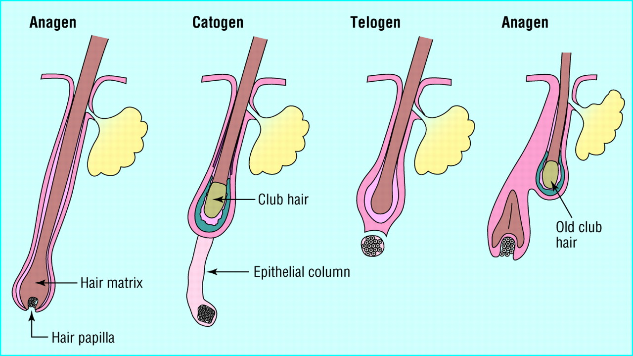 Male pattern androgenetic alopecia | The BMJ