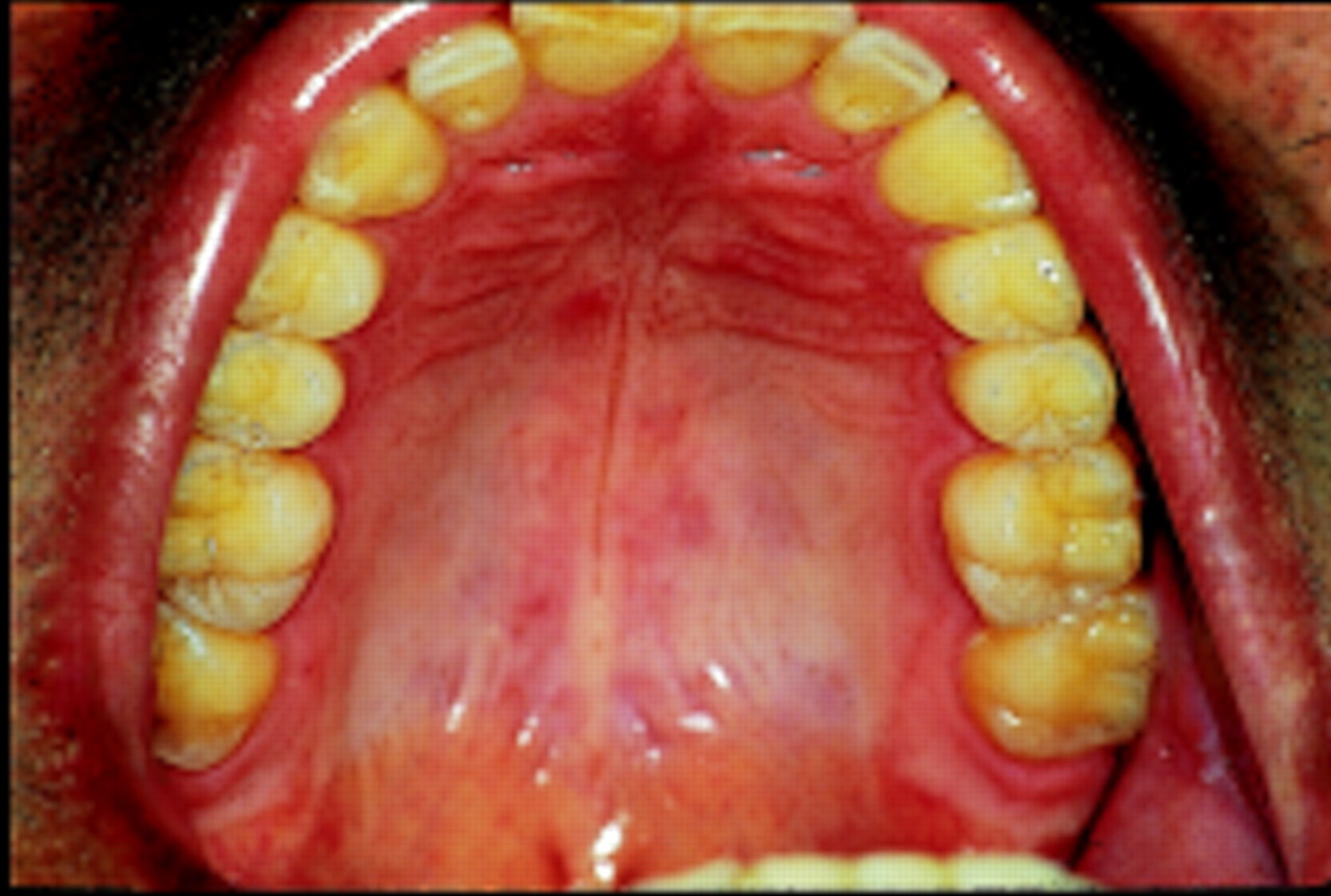 Oral health and disease | The BMJ