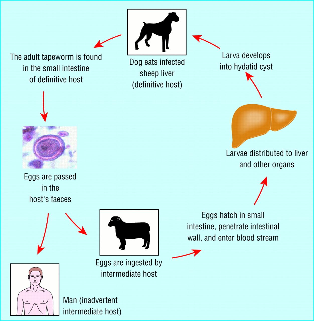 Liver abscesses and hydatid disease | The BMJ