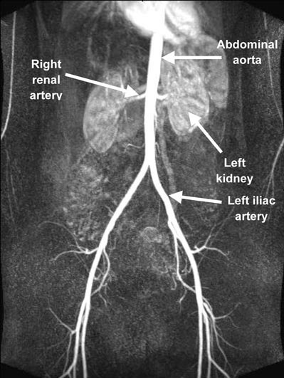 Cardiovascular imaging | The BMJ