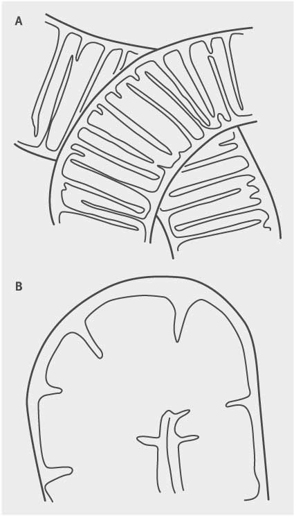 Interpreting abdominal radiographs | The BMJ