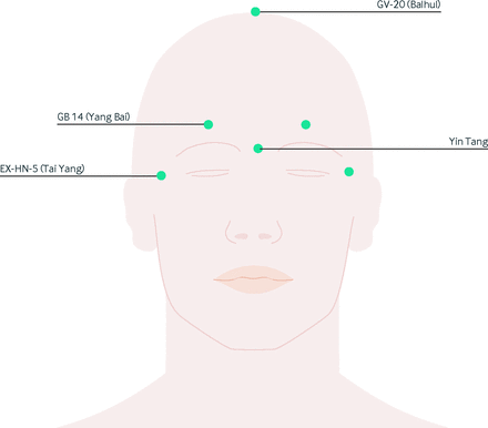 Complementary and integrative medicine in the management of headache ...