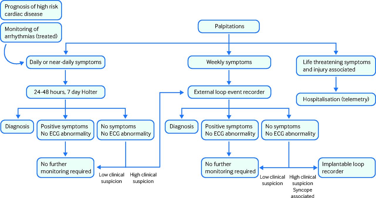 Investigating palpitations: the role of Holter monitoring and loop ...